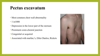 General Physical Examination in Respiratory Diseases | PPTX