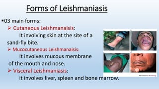 Leishmaniasis | PPTX