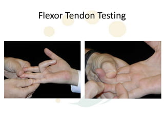Gps flexor-tendon-talk | PPTX