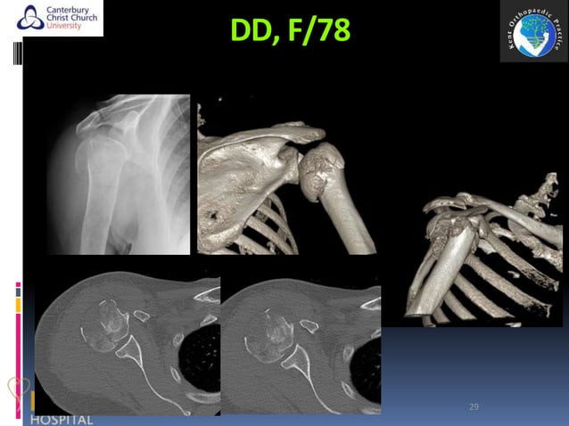 Gp talk june 2017 | PPT