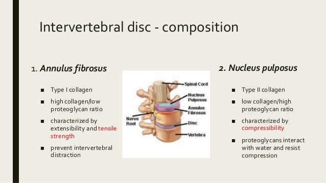 Herniated Nucleus Pulposus