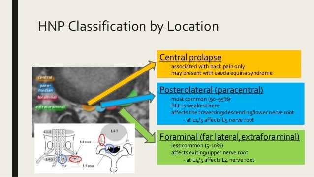 Herniated nucleus pulposus