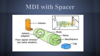 Lecture 4: Inhalation Therapy | PPT