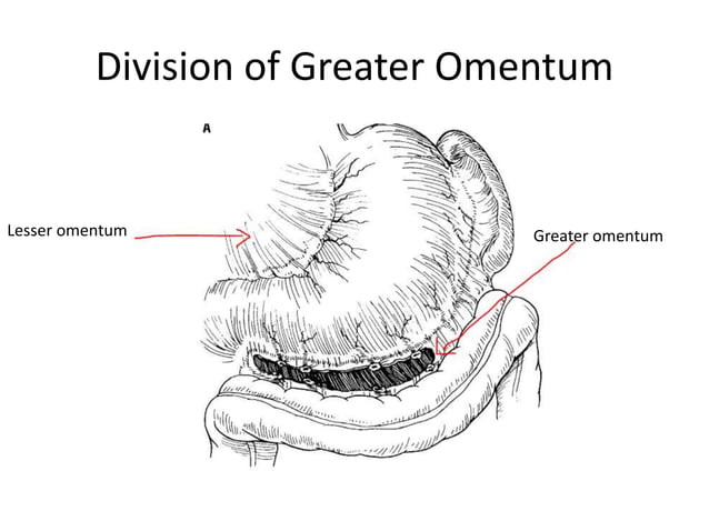 gastric resection, reconstruction and post gastrectomy syndromes