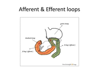 gastric resection, reconstruction and post gastrectomy syndromes | PPT