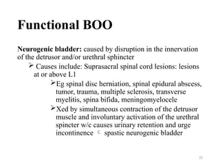 Comprehensive Approach to Acute Urinary Retention: Causes, Anatomy, and ...