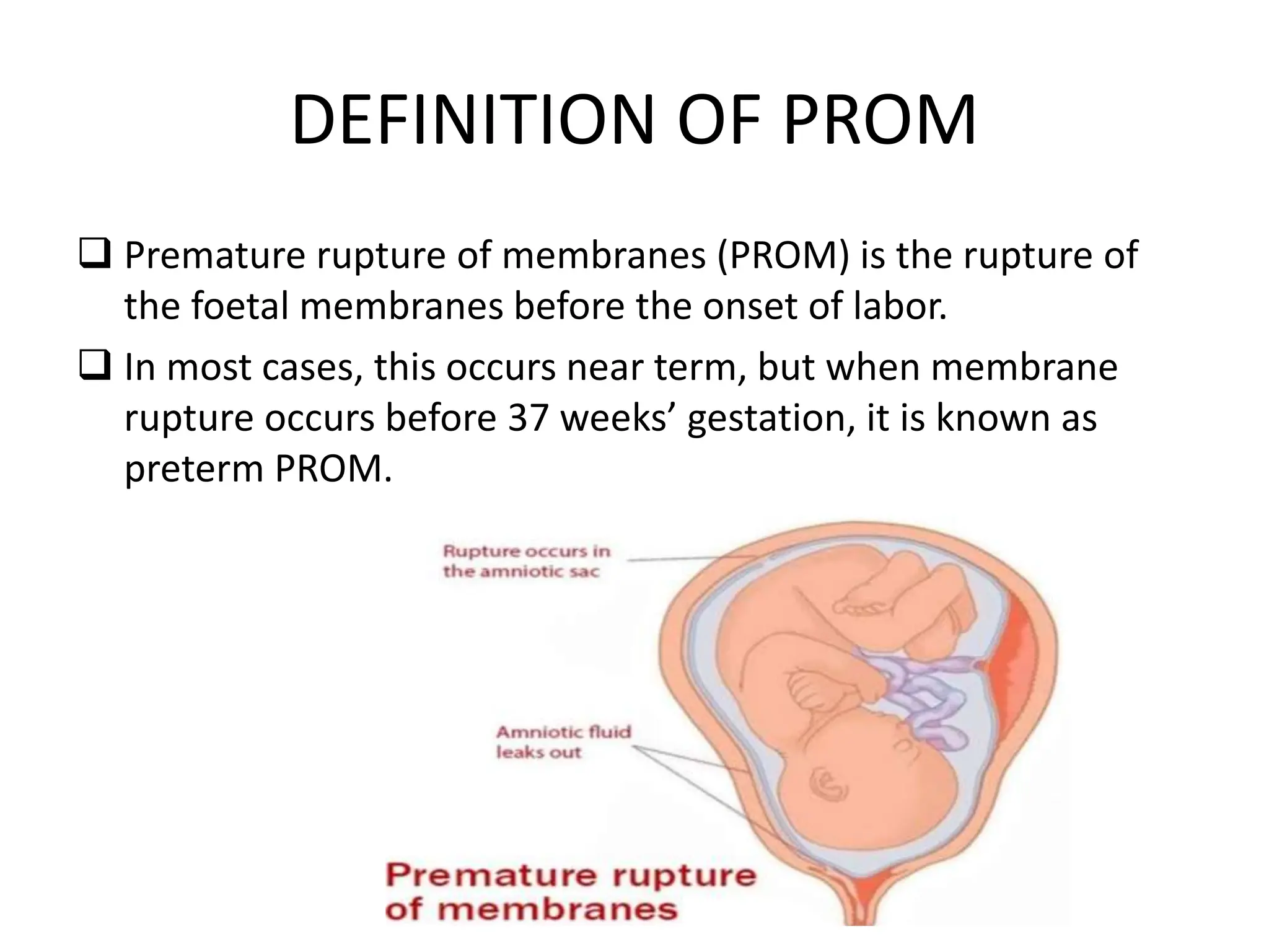 GR 7 PROM in pediatric.pptx2222222222222 | PPT