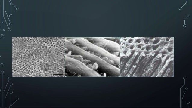 Grabado Ácido En Esmalte