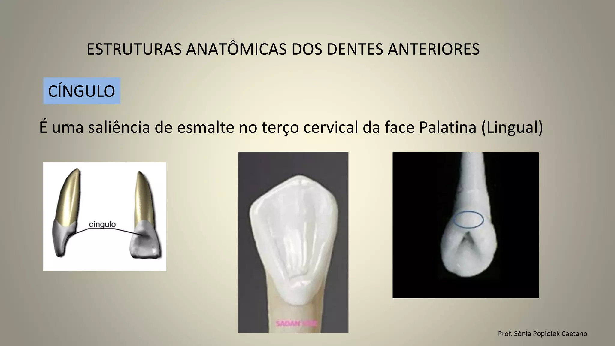 GRAD - DENTES ANTERIORES.pdf | Dental Health | Diseases and Conditions