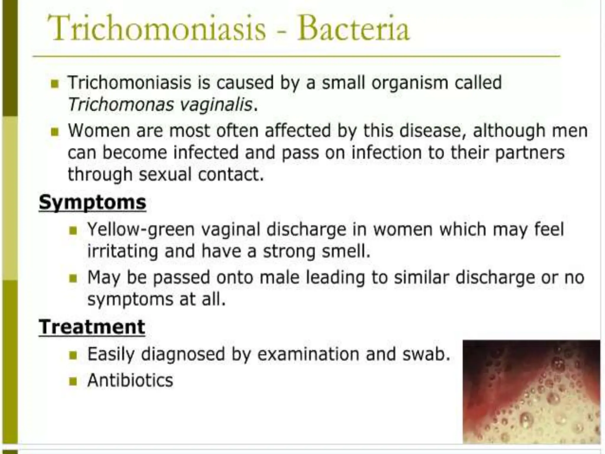 Grade-9-Sexually-Transmitted-Infections.pptx