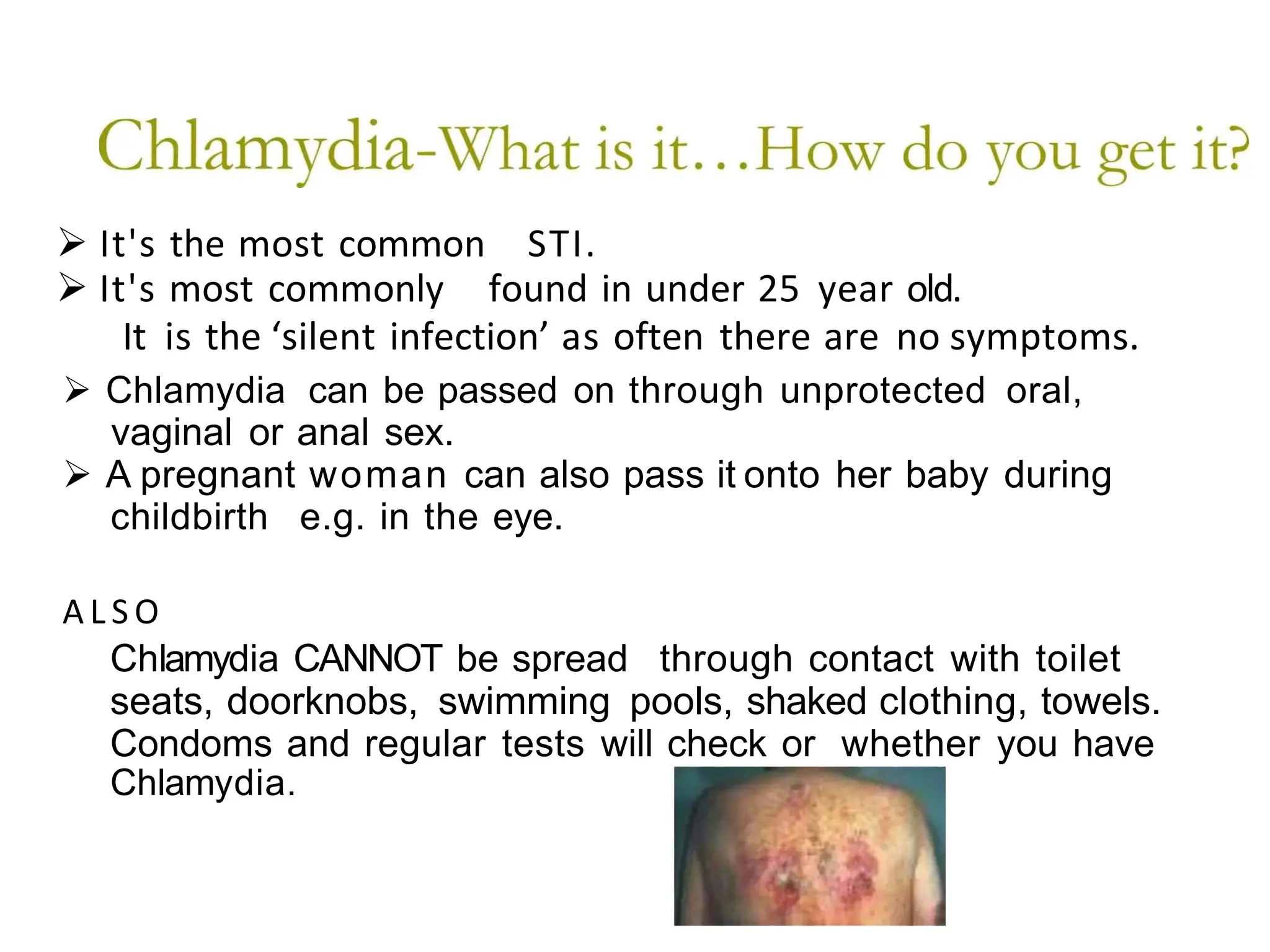 Grade-9-Sexually-Transmitted-Infections.pptx