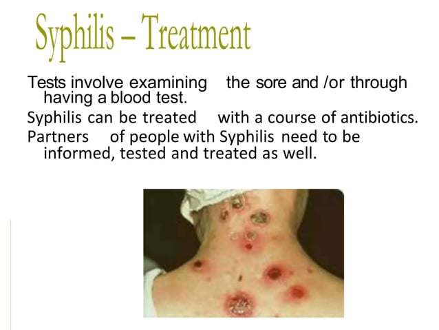 Grade-9-Sexually-Transmitted-Infections.pptx