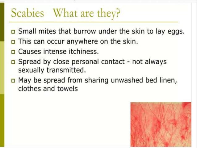 Grade-9-Sexually-Transmitted-Infections.pptx
