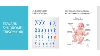 GRADE10GENETICDISORDERsciencediscoveries.pptx