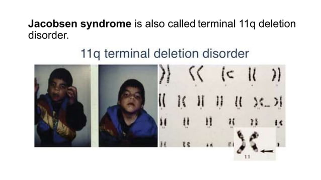 Grade 10 Lesson Mut.pptx | Genetics | Science