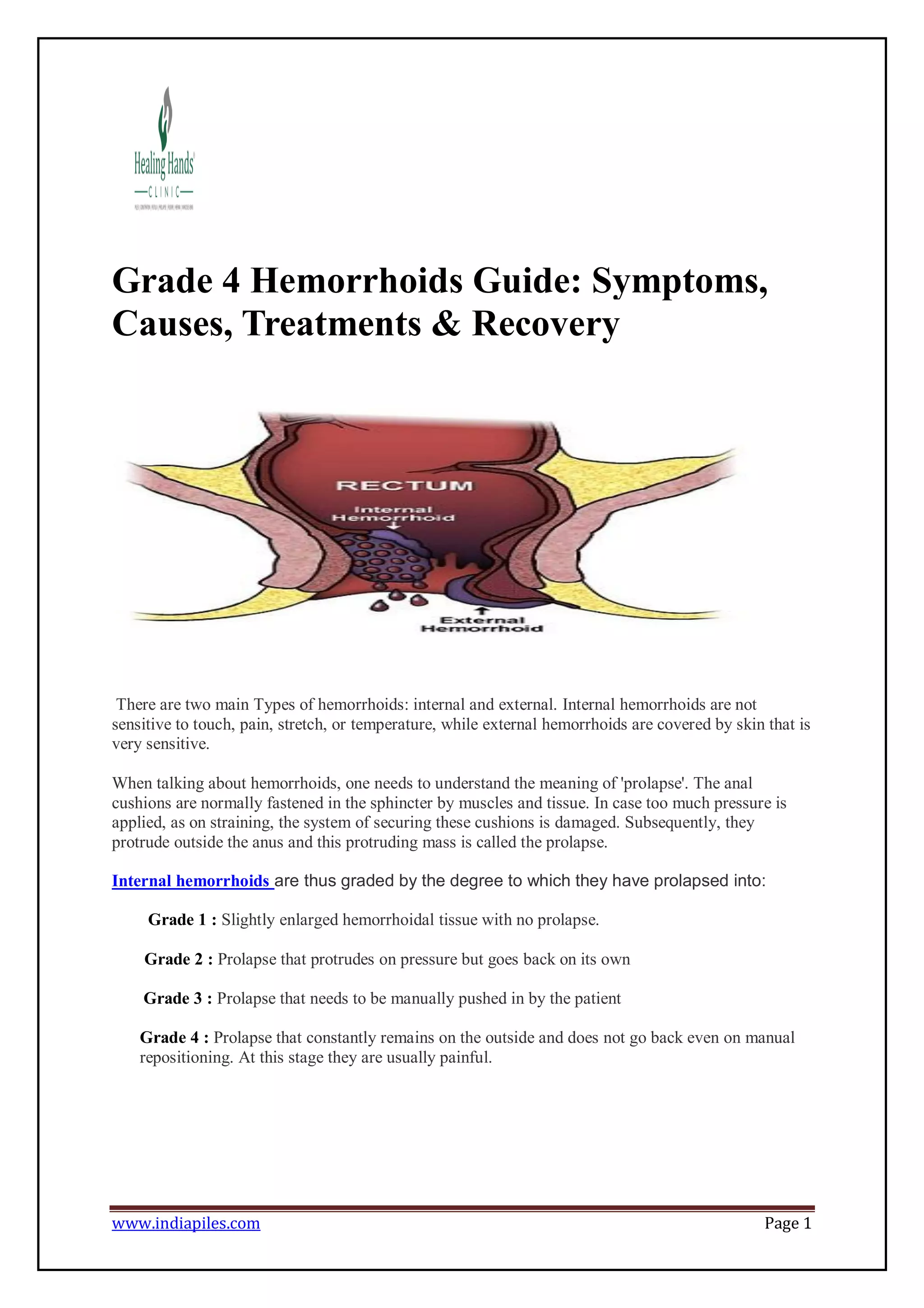 Grade 4 hemorrhoids | PDF