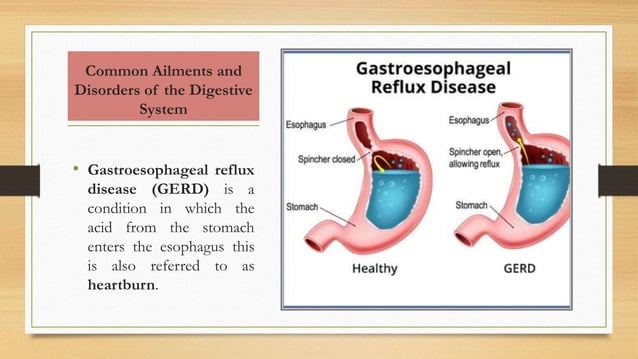 Grade 7 chapter1 lesson1 - the digestive system | PPTX | Digestive ...