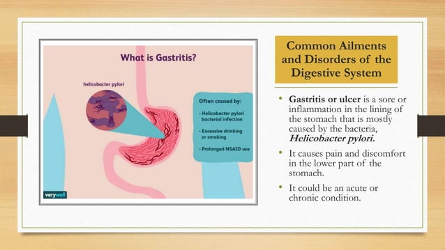 Grade 7 chapter1 lesson1 - the digestive system | PPTX | Digestive ...