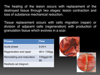 Grade 2 muscle injuries treatment with Cryo Mag | PPT
