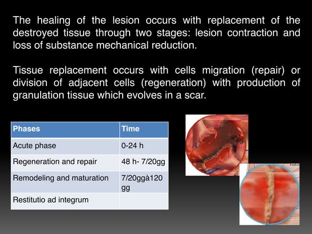 Grade 2 muscle injuries treatment with Cryo Mag | PPT