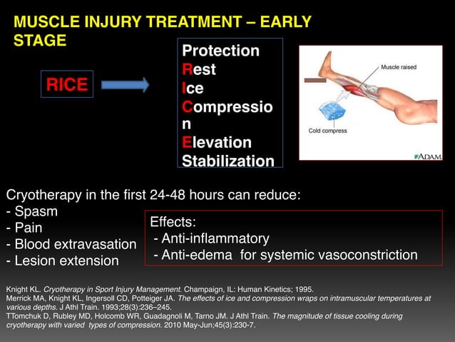 Grade 2 muscle injuries treatment with Cryo Mag | PPT