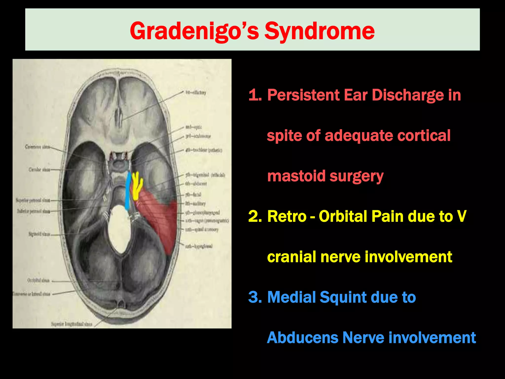 Gradenigo's syndrome .ppt