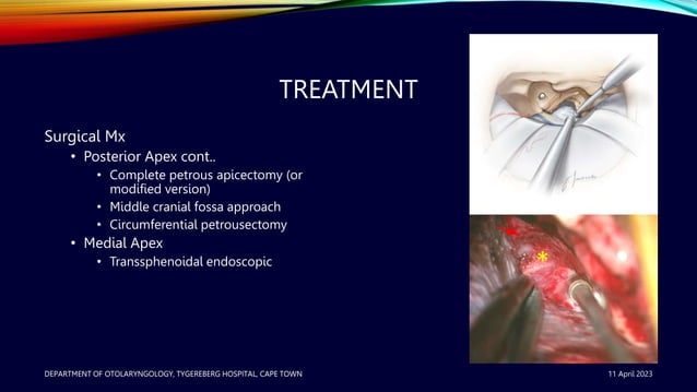 GRADENIGO SYNDROME | PPTX | Ear, Nose and Throat Conditions | Diseases ...