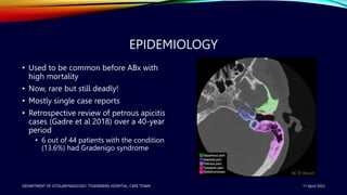 GRADENIGO SYNDROME | PPTX