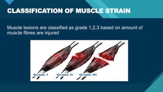 Grades of muscle strain (1).pptx