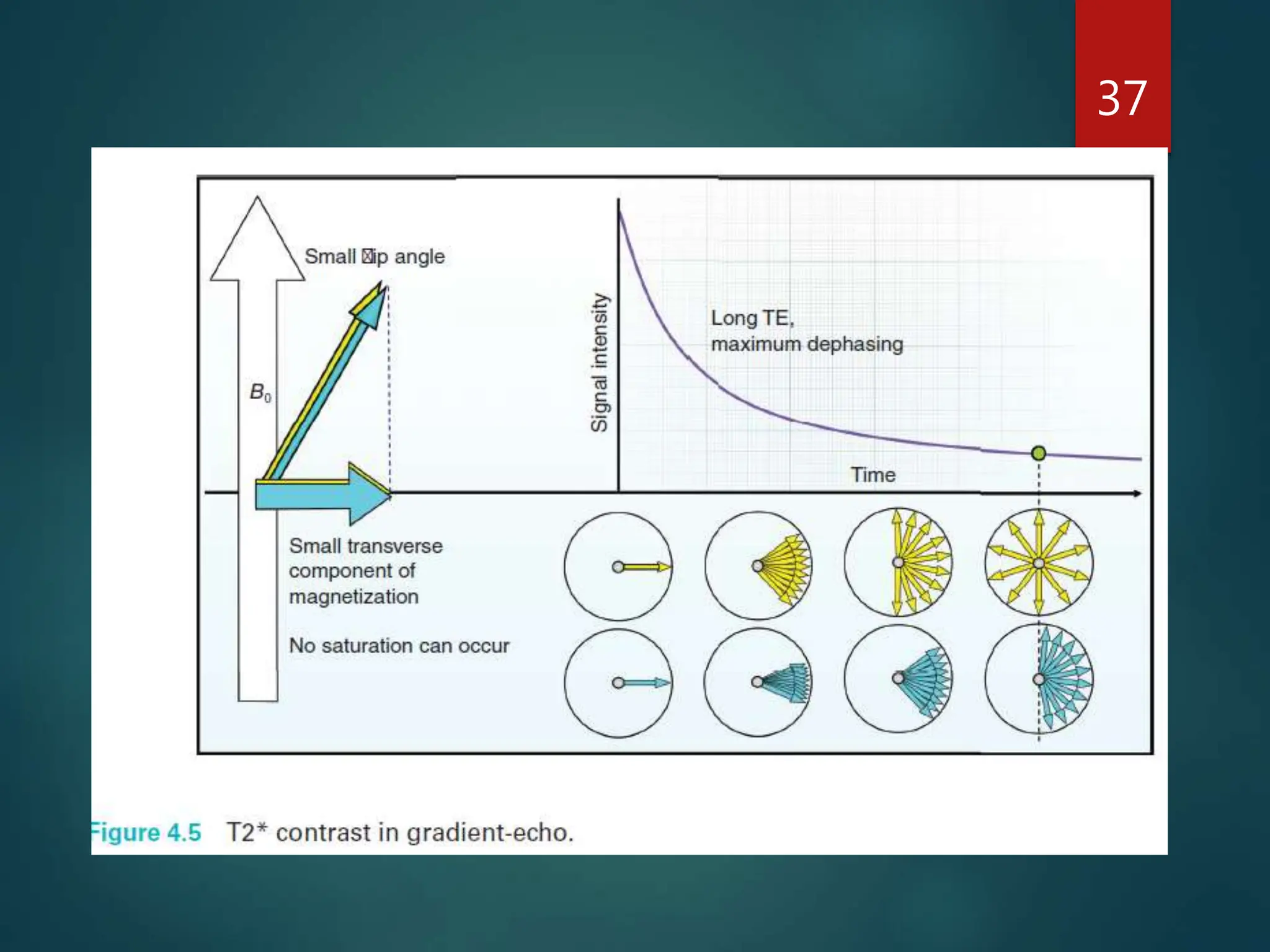 gradientechopulsesequence of MRI latest editiin | PPT