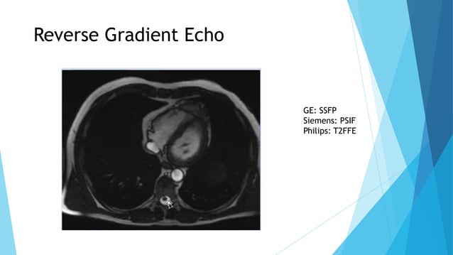 Gradient echo pulse sequences hjn.pptx