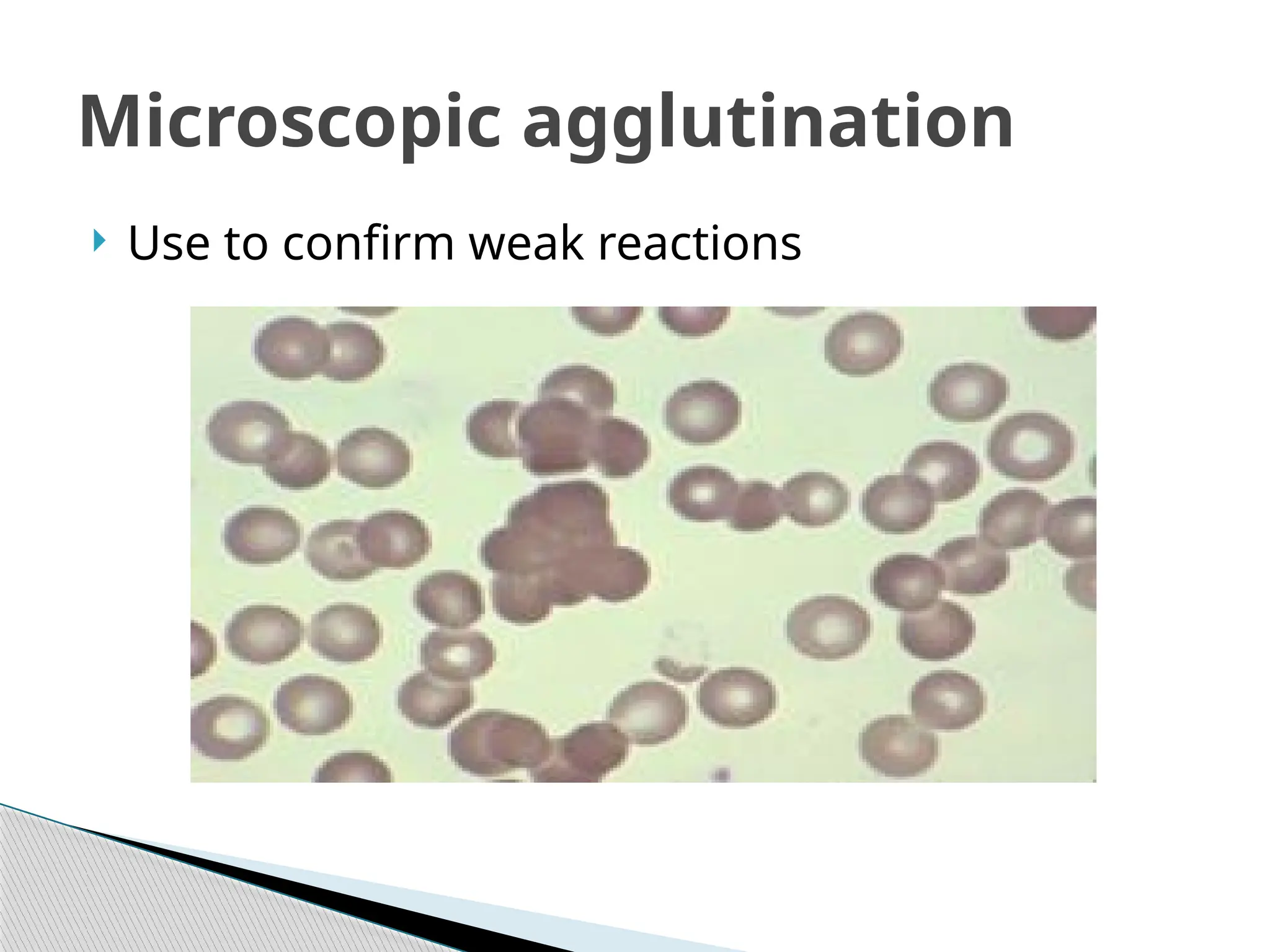 Gradddding turbilatex agglutination.pptx
