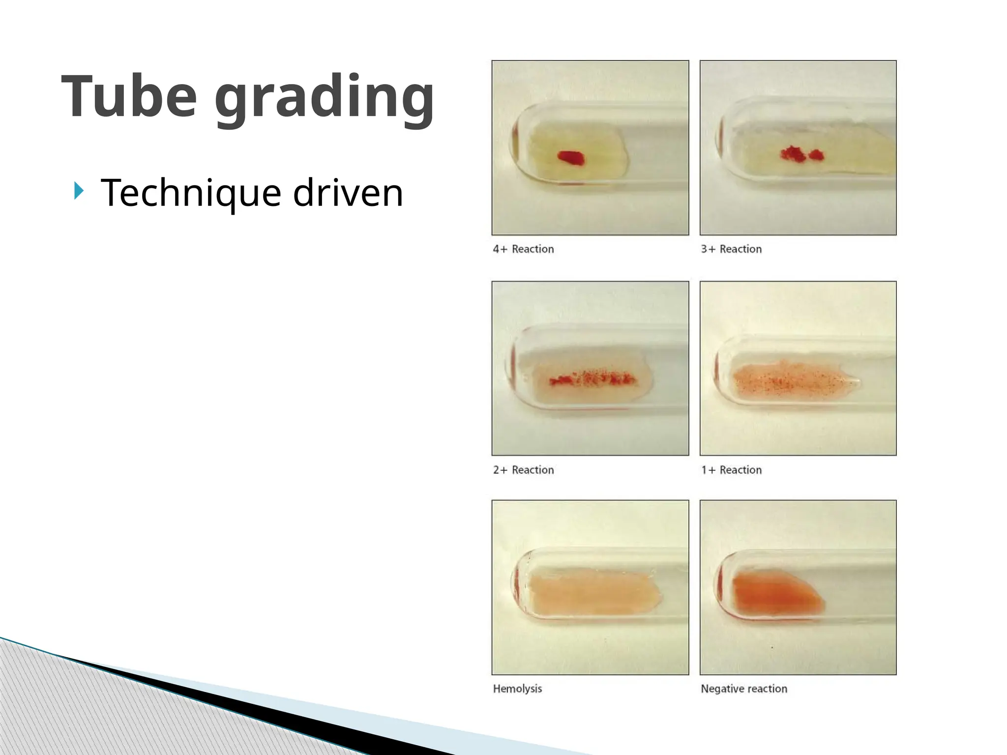 Gradddding turbilatex agglutination.pptx