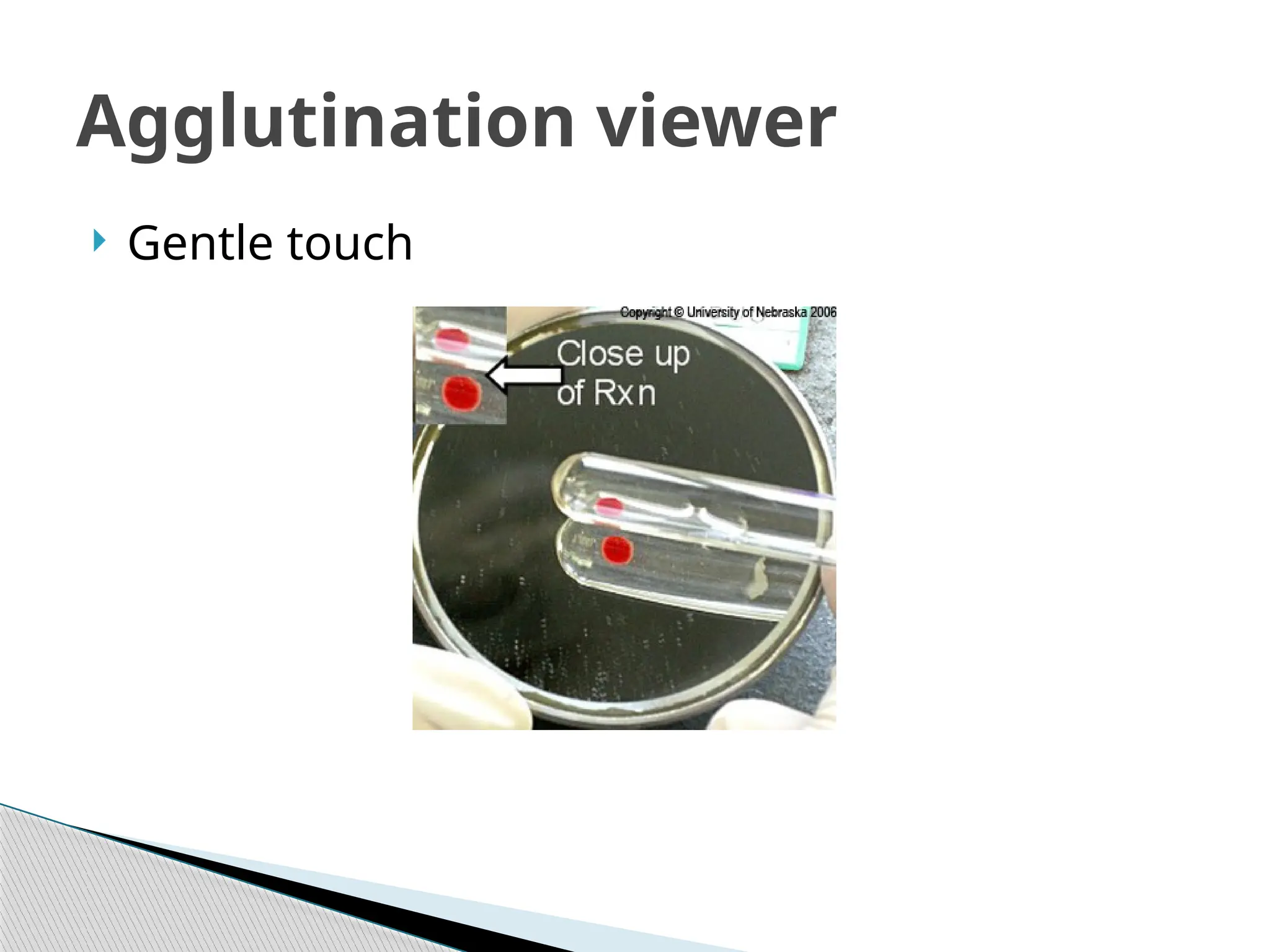 Gradddding turbilatex agglutination.pptx