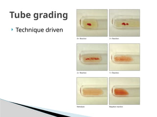 Gradddding turbilatex agglutination.pptx