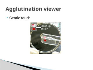 Gradddding turbilatex agglutination.pptx