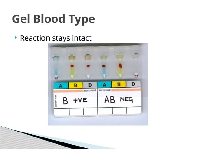 Gradddding turbilatex agglutination.pptx