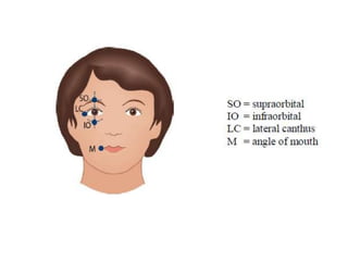 Grading facial nerve_function | PPTX