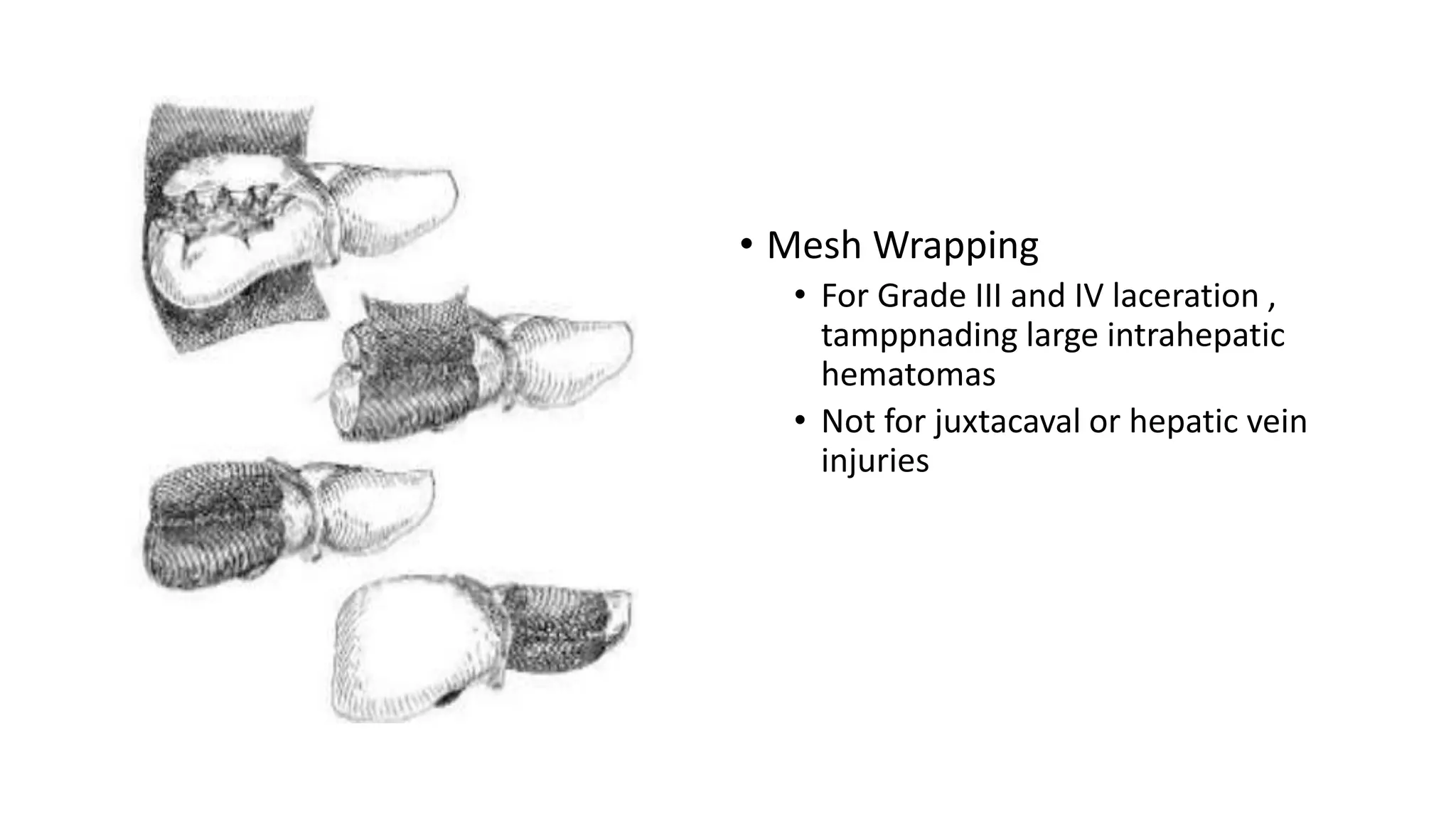 Grading of liver and kidney injuries | PPTX