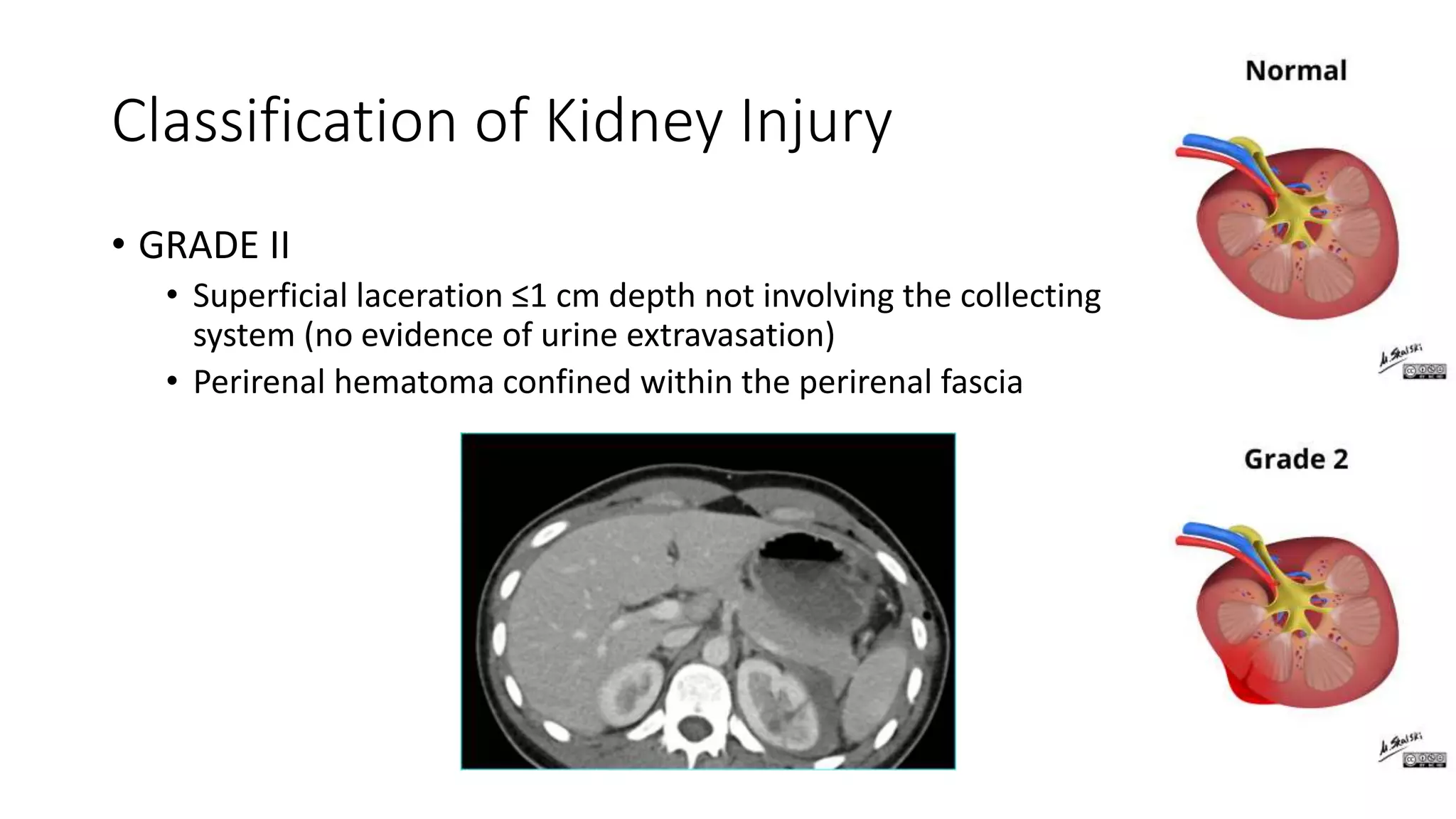 Grading of liver and kidney injuries | PPTX