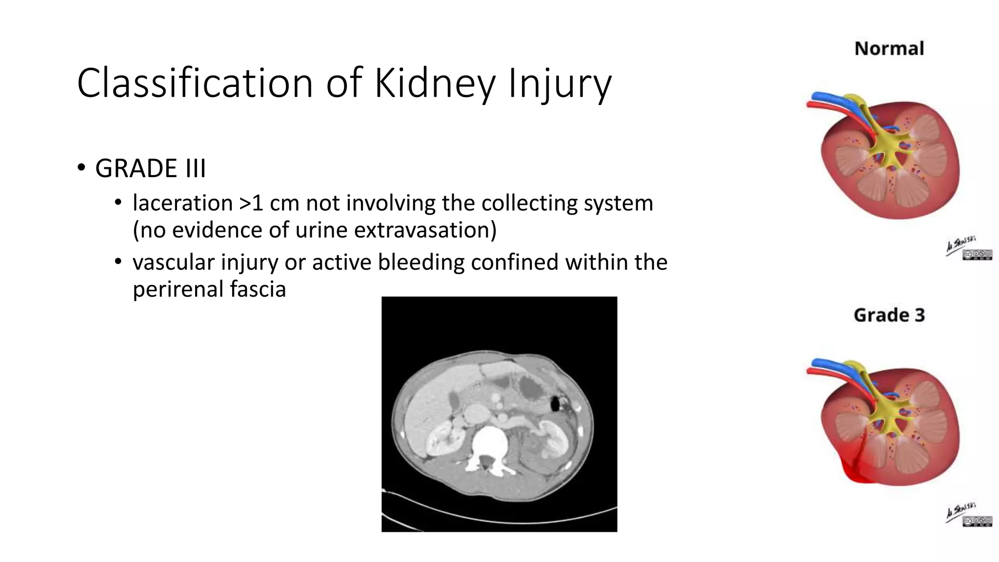 Grading of liver and kidney injuries | PPTX