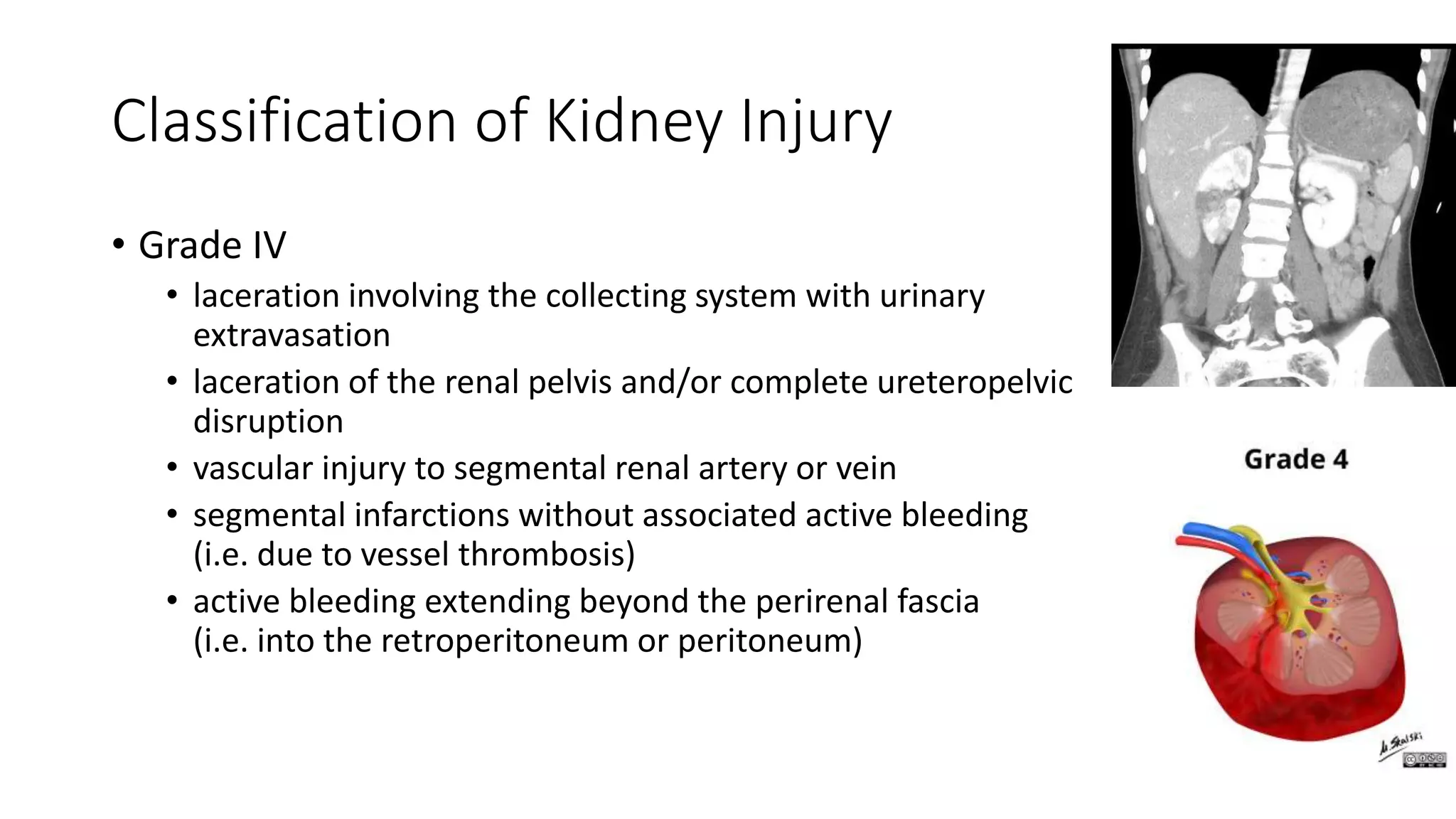 Grading of liver and kidney injuries | PPTX