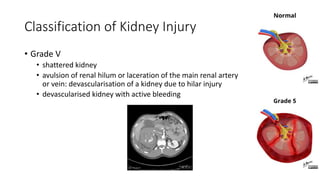 Grading of liver and kidney injuries | PPTX
