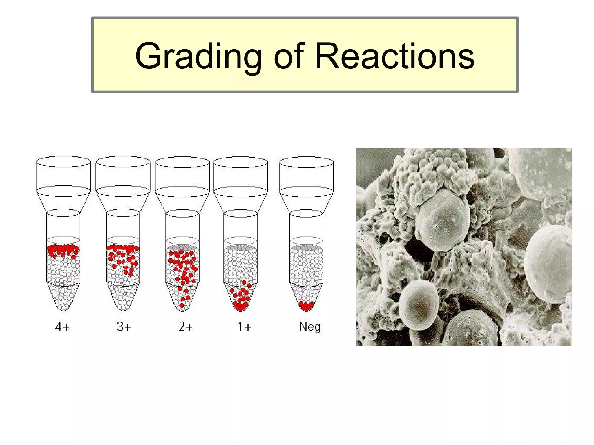 Grading of Reactions.pdf