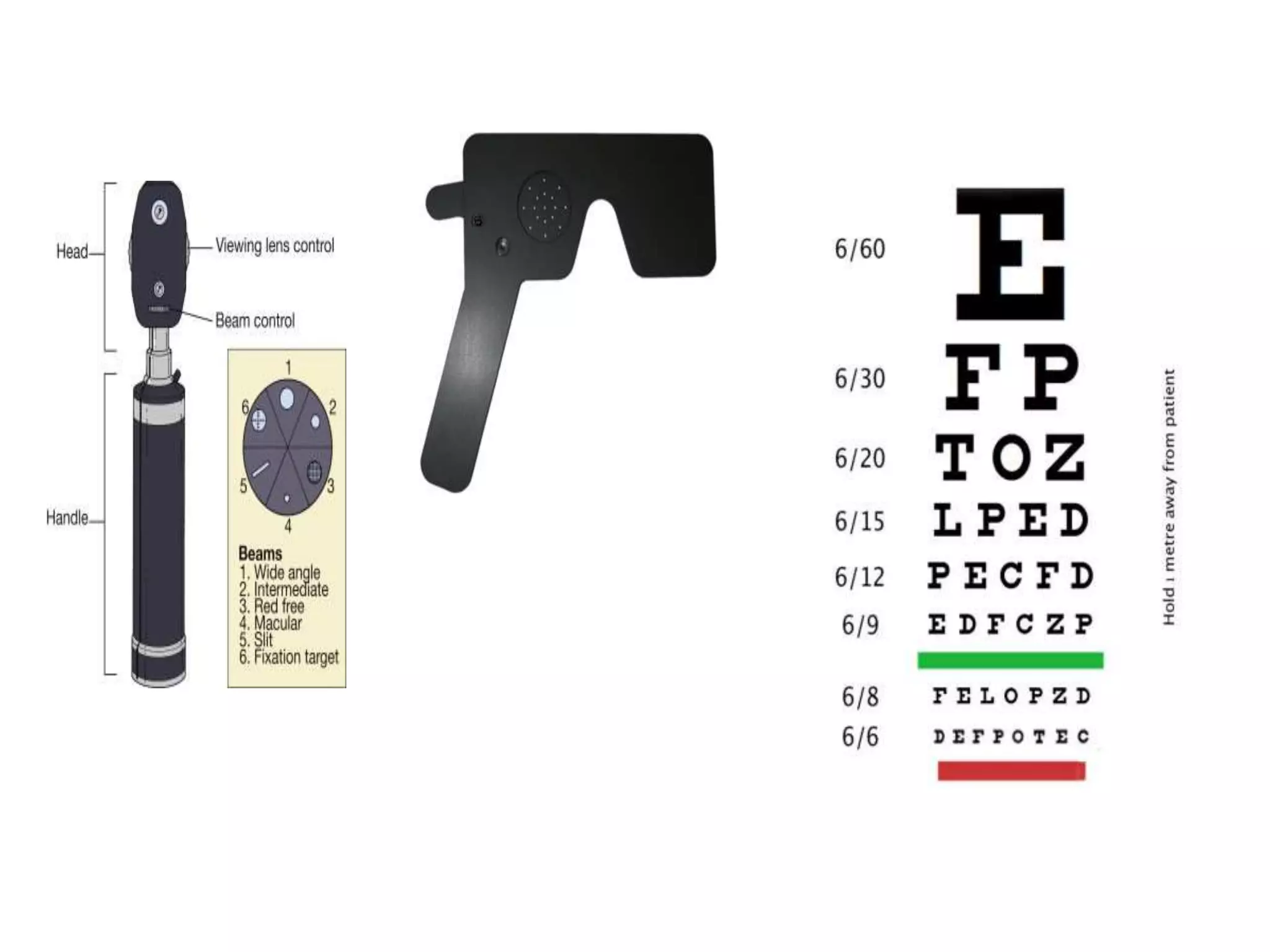 Gradual loss of vision (opthalmology) | PPTX