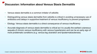 GR AFHS Diff Venous Stasis Derm from Cellulitis.-w-o CH.pptx