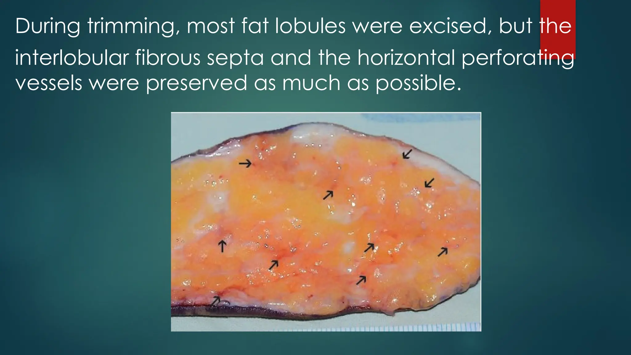 Skin-Fat Composite Grafts for Reconstructing Large Full-Thickness Skin ...