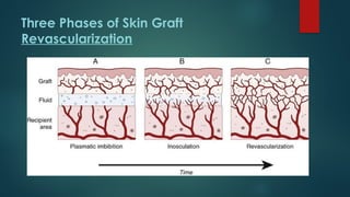 Skin-Fat Composite Grafts for Reconstructing Large Full-Thickness Skin ...