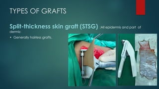 Skin-Fat Composite Grafts for Reconstructing Large Full-Thickness Skin ...
