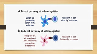 types of graft rejection seminar skin rejection | PPTX